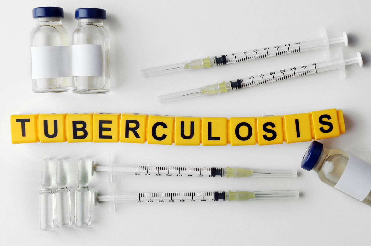 TUBERCULOSIS MULTIRRESISTENTE